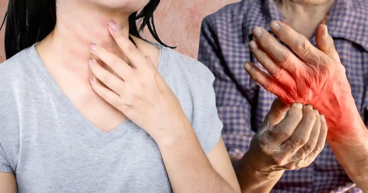 Skin Diseases Made Simple | Types Symptoms and Treatments